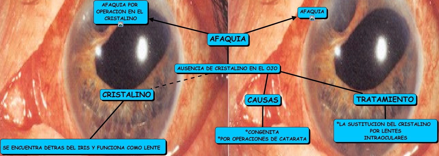 AFAQUIA - ¿QUE ES AFAQUIA?