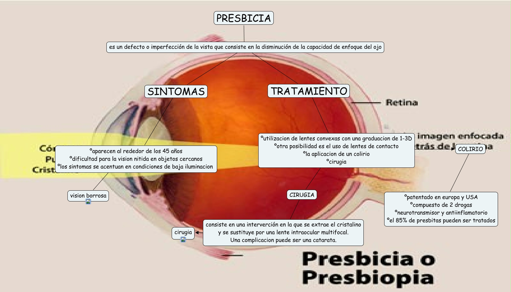 presbicia