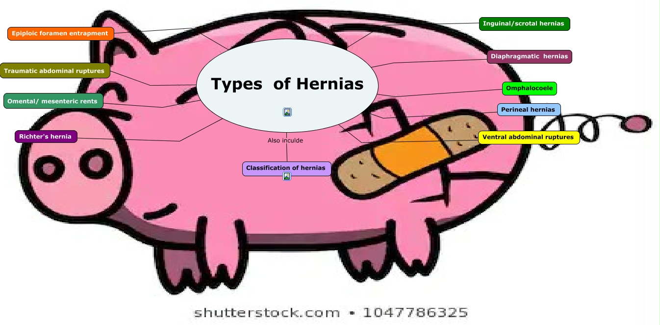types of hernia