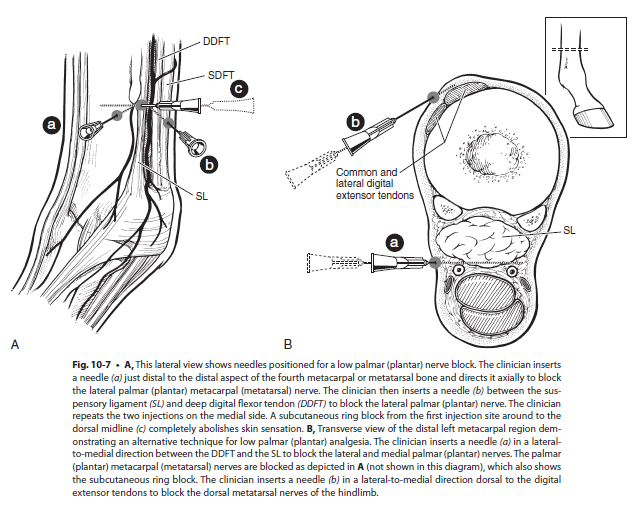 Nerve block 2