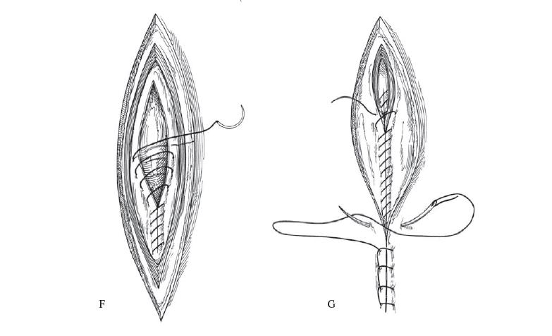 Case 2 - Left Displaced Abomasum