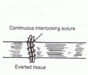 Resection & Anastomoses in a Calf