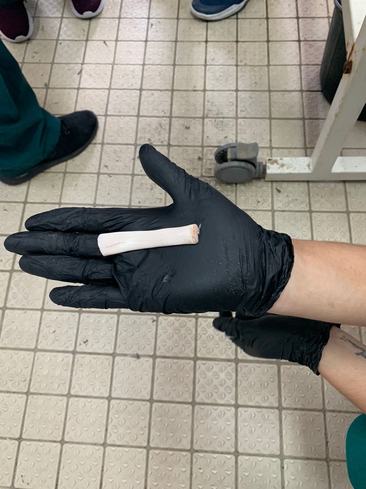 Deep Digital Flexor Tenotomy