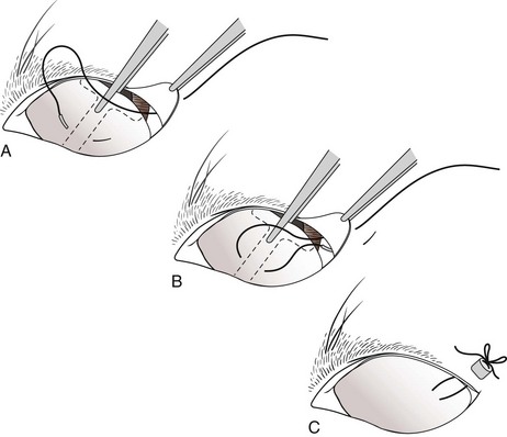THIRD EYELID FLAP PROCEDURE