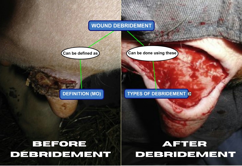 Wound Debridement