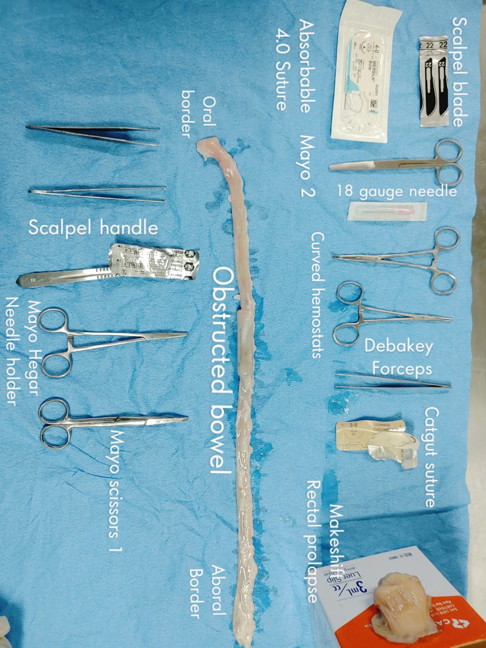 Surgery of the Intestines Final