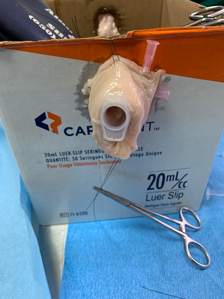 Rectal Prolapse Repair