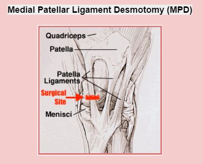 Group 2- Lab 10 - Equine Limb surgery