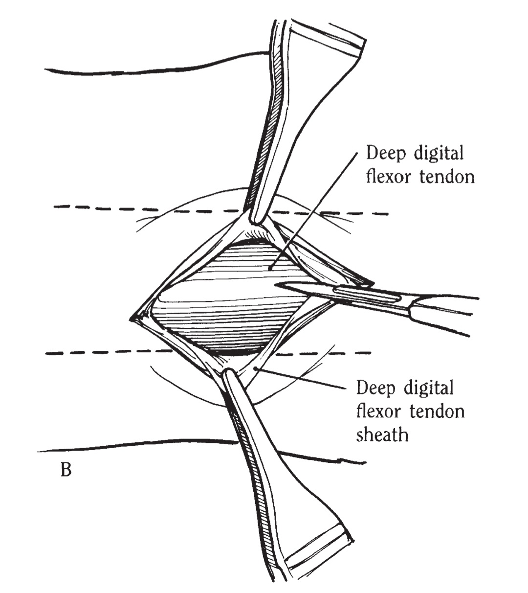 DDFT Procedure